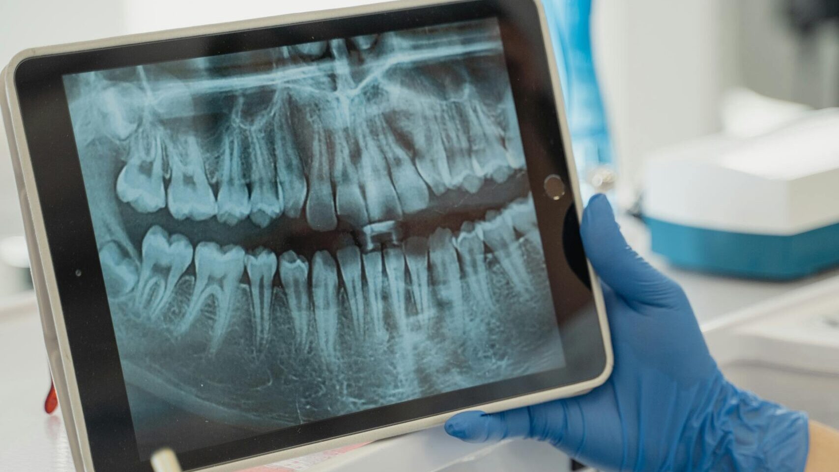 Symptoms of Tooth Infection Spreading to Body (Key Signs)
